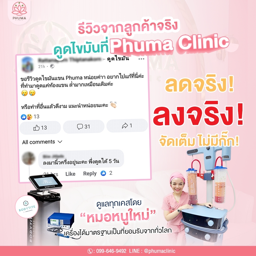 ดูดไขมันราคาเท่าไร? ทำไมต้องสอบถามก่อน? - Phuma clinic (หมอหนูใหม่)