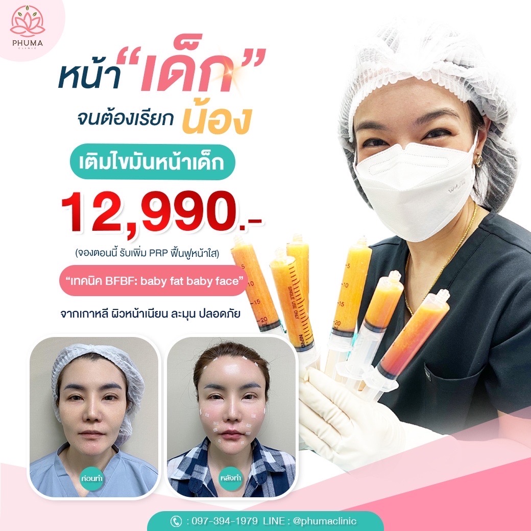 โปรโมชั่น ดูดไขมัน เติมไขมันหน้า และบริการอื่นๆ ของ Phuma clinic หมอหนูใหม่