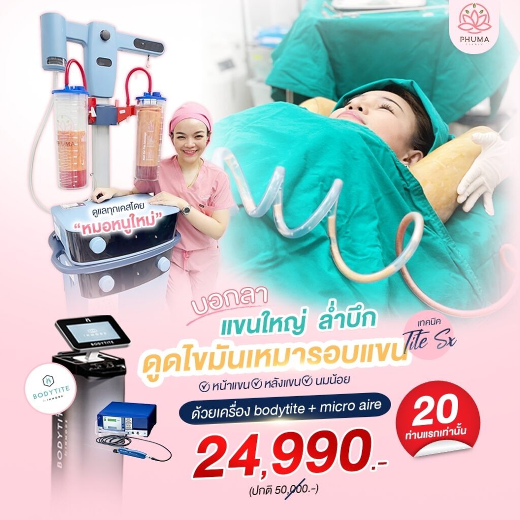 Phuma clinic ดูดไขมัน เติมไขมันหน้า ปรับรูปหน้า แผลเล็ก เจ็บน้อย (หมอ ...