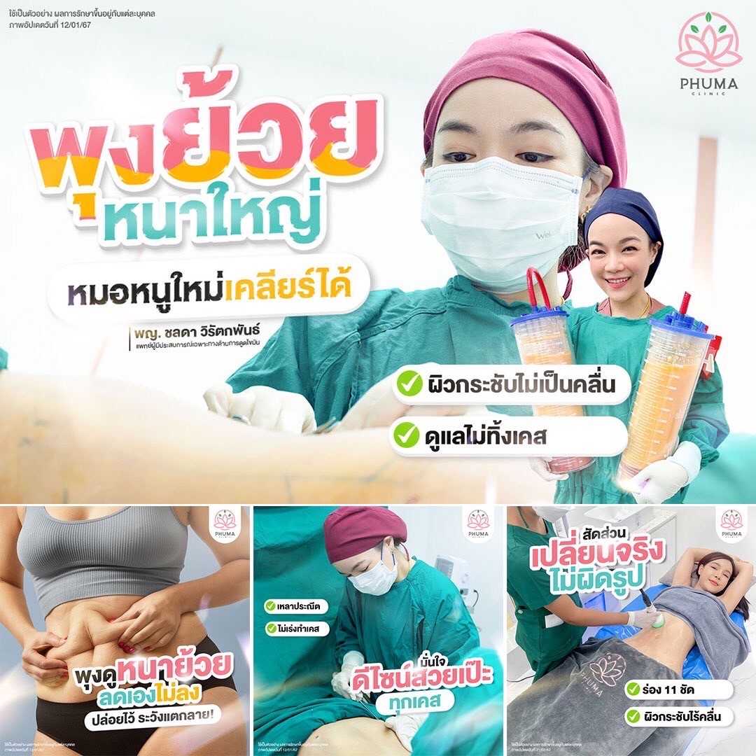 บทความ - Phuma clinic พญ.ชลดา วิรัตกพันธ์ (หมอหนูใหม่)